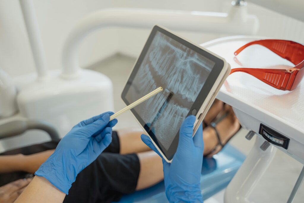 Microscope-Enhanced Endodontics: Why It Improves Outcomes | Root Canal ...