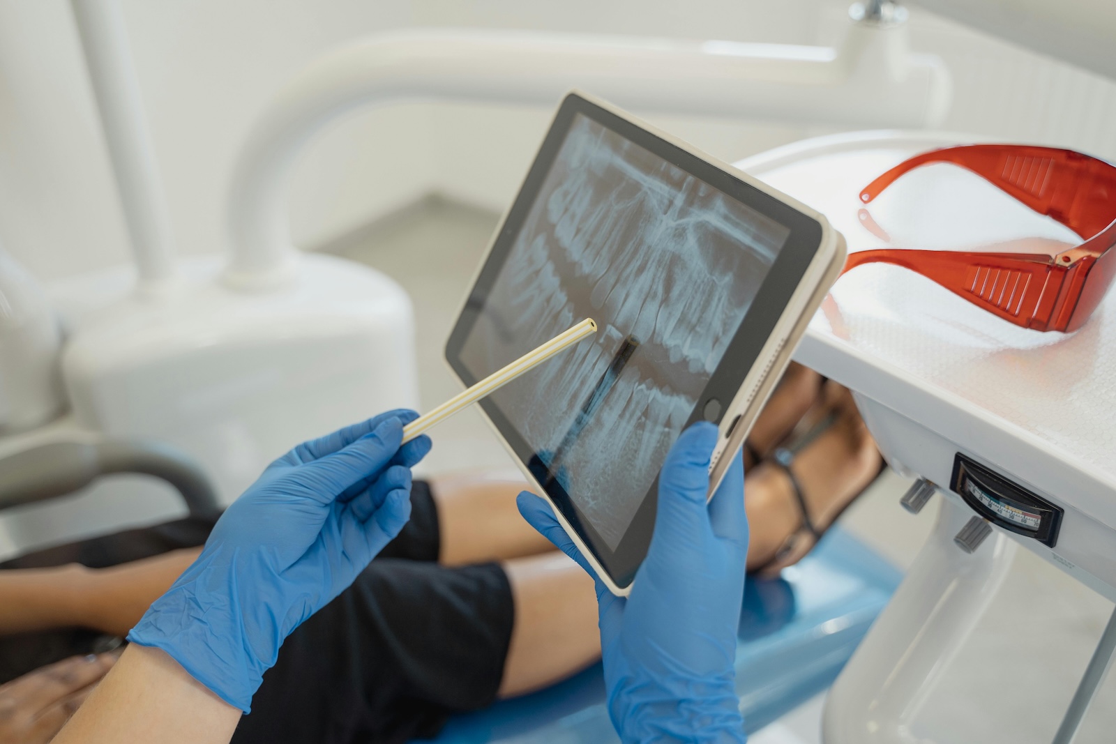 Why Microscope Endodontics | Root Canal Specialists of Baton Rouge